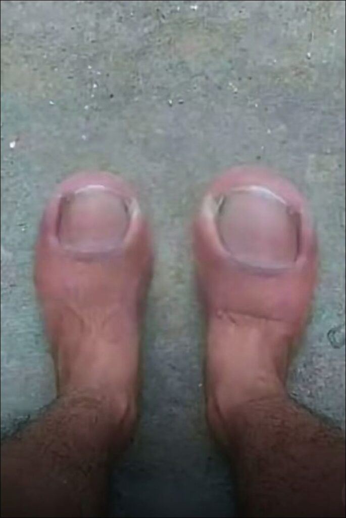 [1005+] Goofy Ahh Pictures, Meme, PFP, Funny & Wallpapers (2025 ...